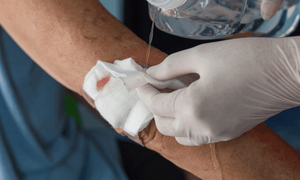 Wound Care Training ~ London Institute of Business and Management